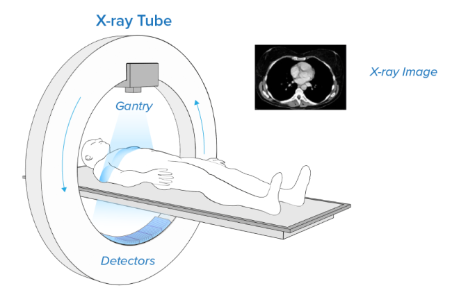 Quality assurance testing in computed tomography | RaySafe